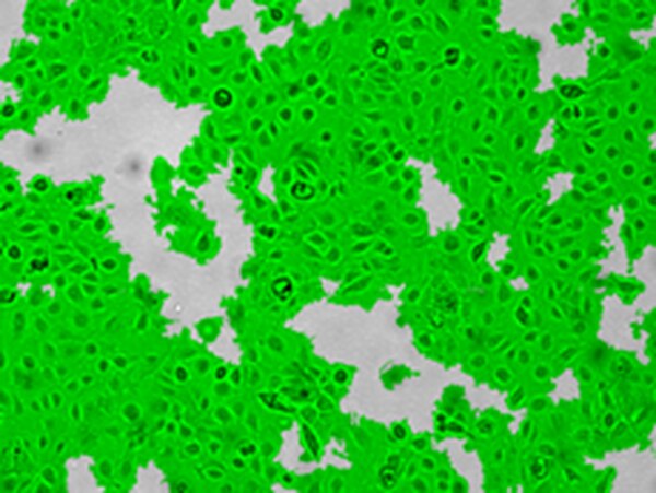 MOC1 Mouse Oral Squamous Cell Carcinoma (OSCC) Cell Line | SCC469